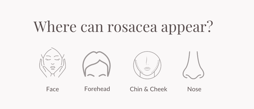 How to treat Redness at the Dermatology Institute of Victoria Melbourne ...