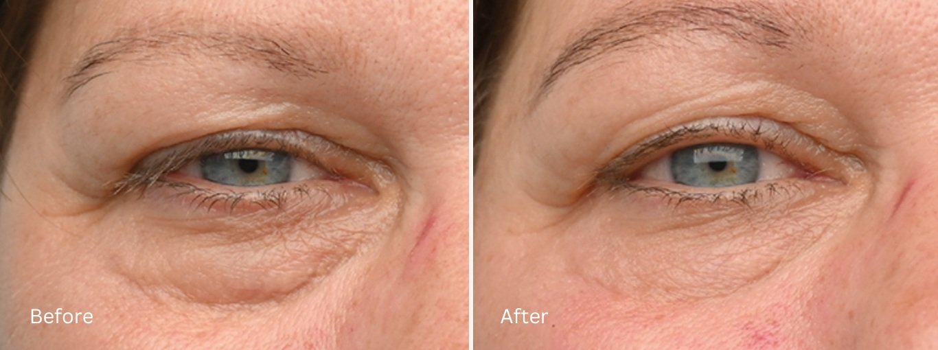 EmFace — The Dermatology Institute of Victoria | Melbourne Dermatologists