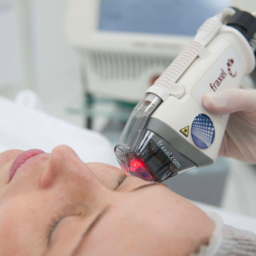 Fraxel Dual Laser at the Dermatology Institute of Victoria — The ...