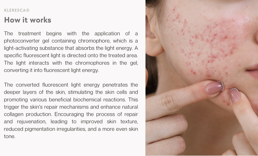 Kleresca® — The Dermatology Institute of Victoria | Melbourne ...