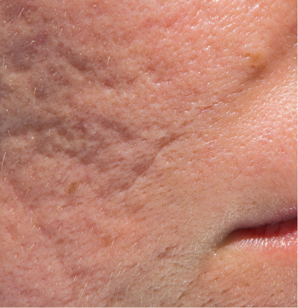 The Dermatology Institute of Victoria | Melbourne Dermatologists— Can ...