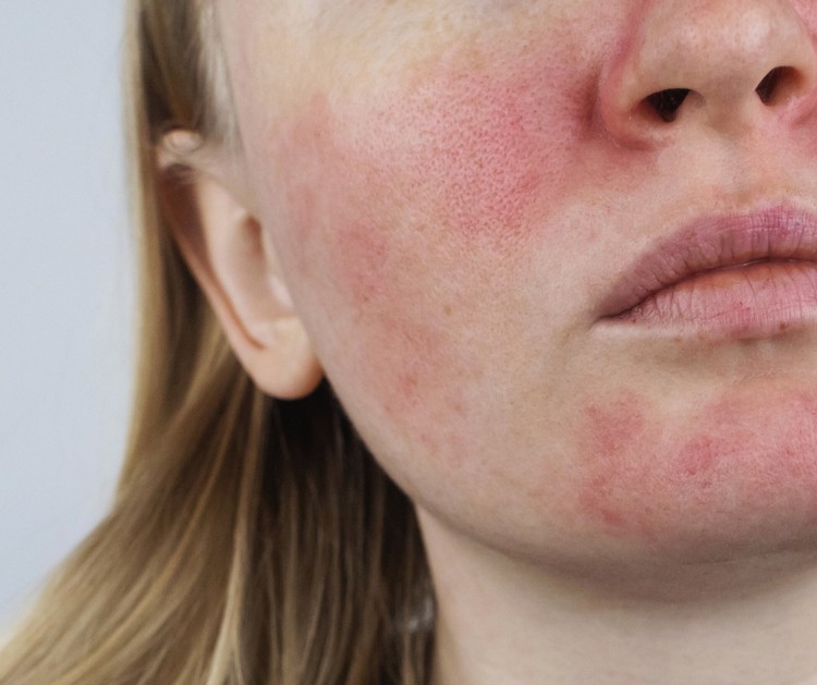 The Dermatology Institute of Victoria | Melbourne Dermatologists