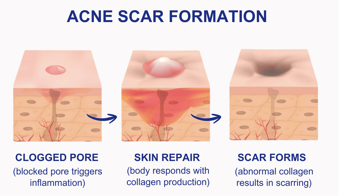 The Dermatology Institute of Victoria | Melbourne Dermatologists— Can ...