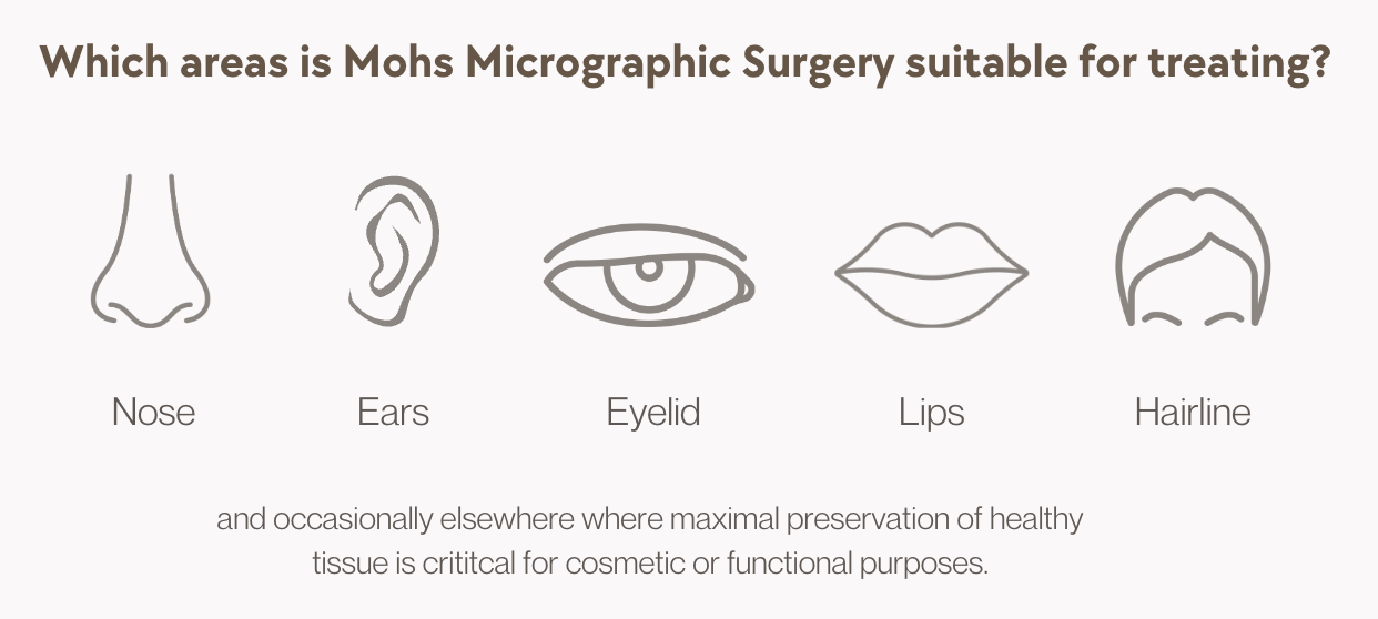 Mohs Micrographic Surgery at the Dermatology Institute of Victoria ...