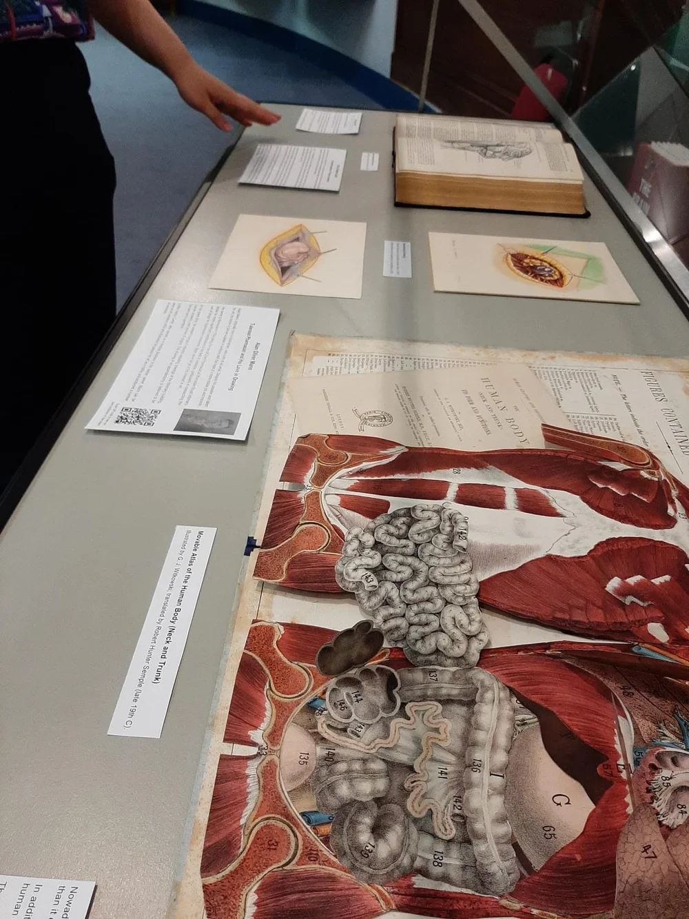 George Marshall Medical Museum Temporary Exhibition — Worcester Medical ...