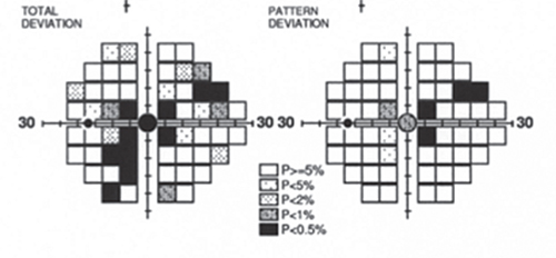 Technology — Advanced Clinical Eyecare