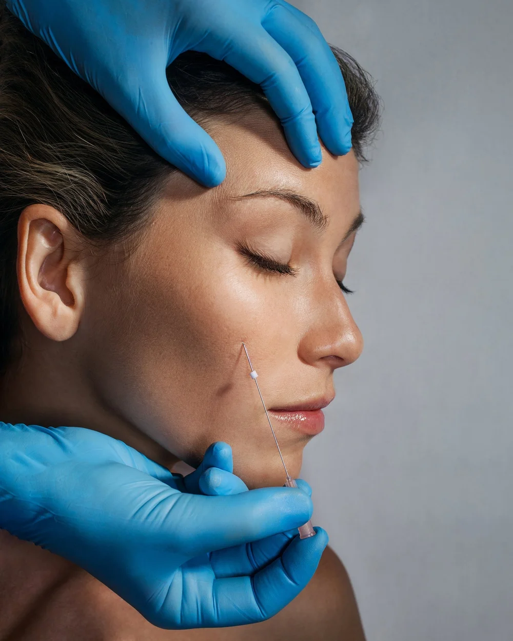 PDO Thread Lift | Non-surgical Face Lift Ann Arbor & Wyandotte — Med 1 ...