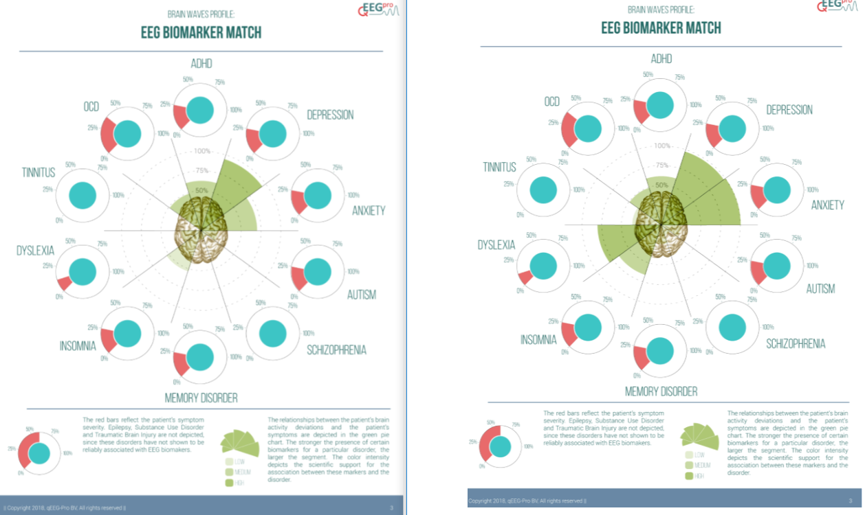 Neurohacking Experiments - EEG Reading Profile Report Analysis — The ...