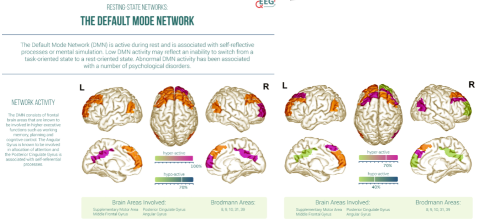 Neurohacking Experiments - EEG Reading Profile Report Analysis — The ...