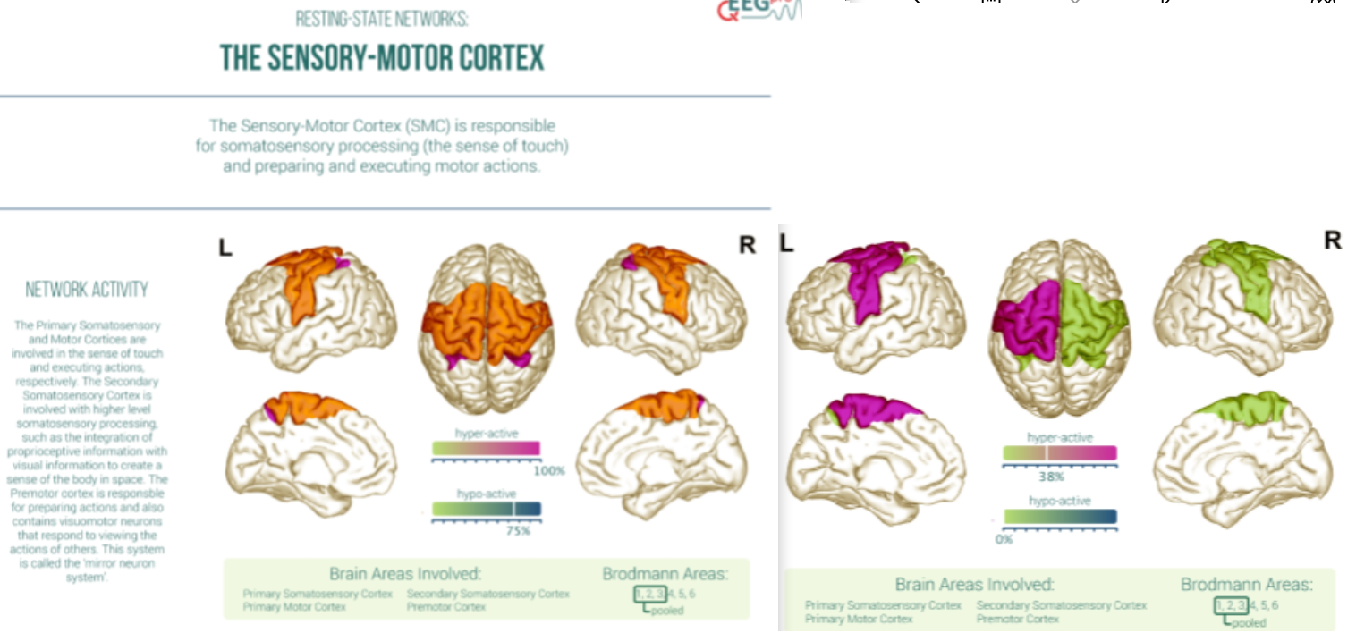 Neurohacking Experiments - EEG Reading Profile Report Analysis — The ...