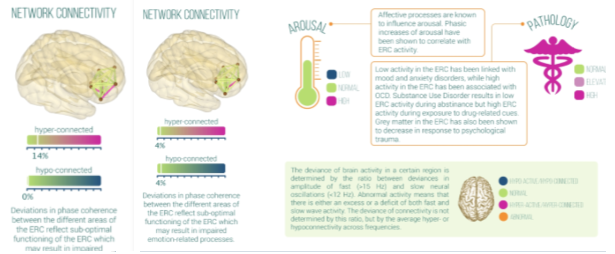 Neurohacking Experiments - EEG Reading Profile Report Analysis — The ...