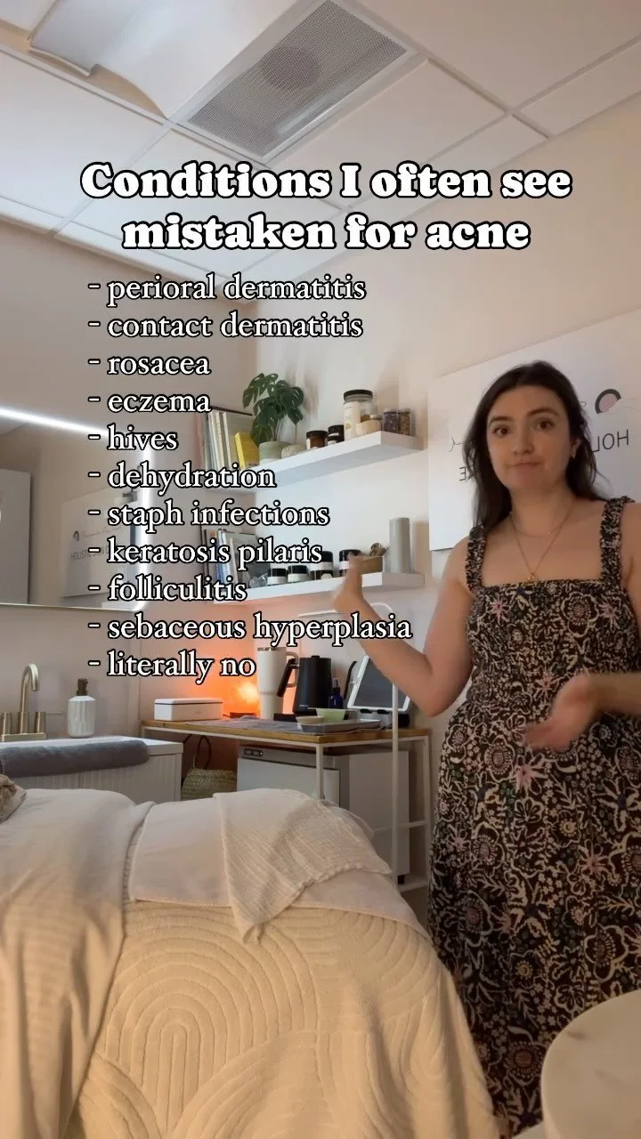 How to embrace flaws!-Therapeutic Skin Coach