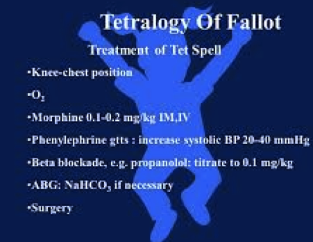 Knee Chest Position Tetralogy Fallot