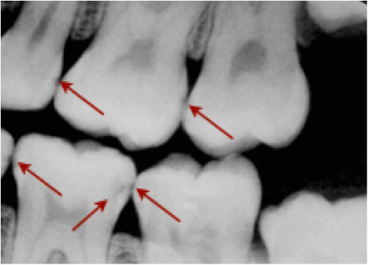 Northbridge Dentists - Prevention and Maintenance