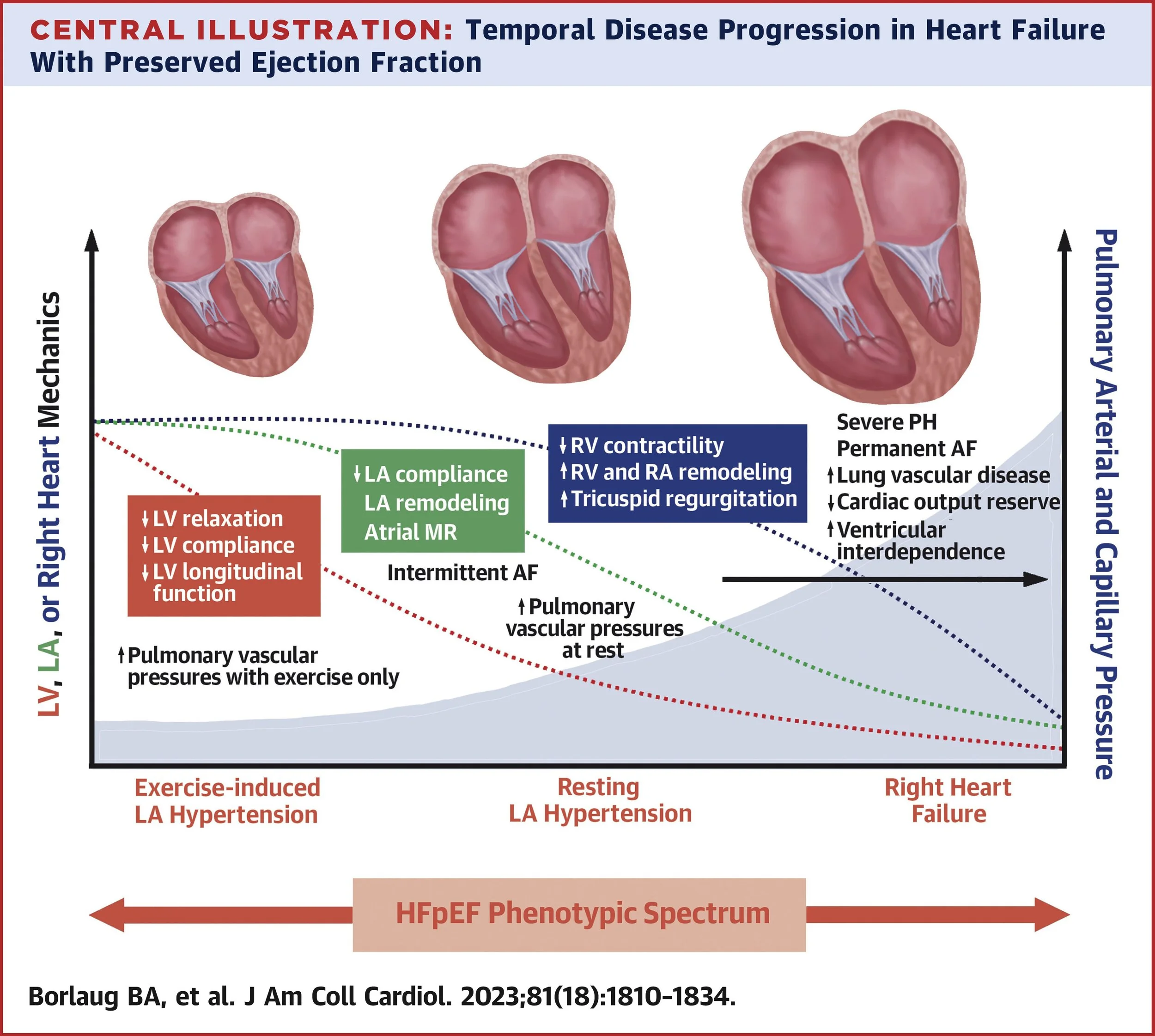 HFpEF - heart failure with preserved ejection fraction — Cardiology ...