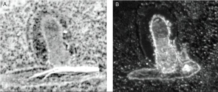 HTX AN-28 MALDI Imaging of Metabolites in Root Nodule Tissue — HTX Imaging