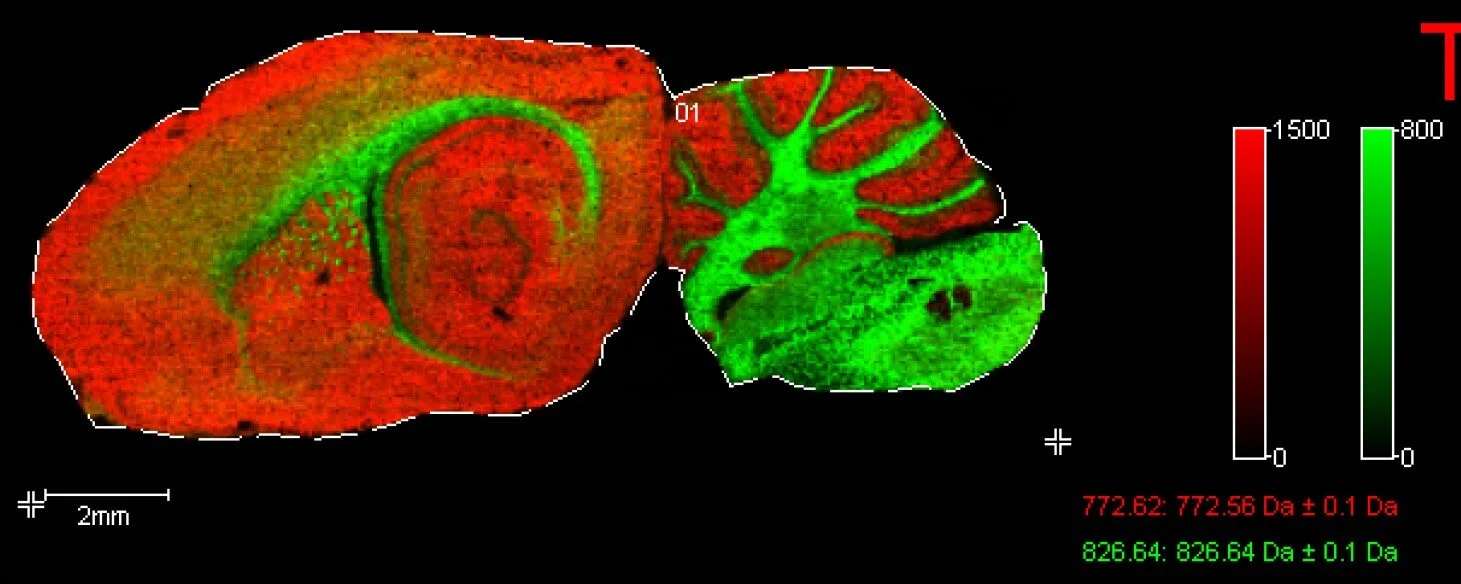 MALDI Mass Spectrometry Imaging of lipids in positive and negative ion ...