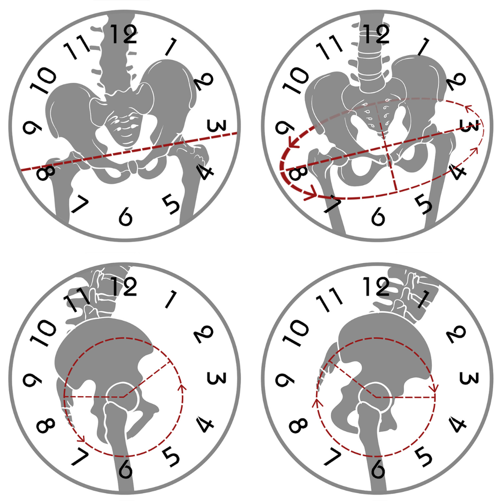 About - FR — Pelvic Clock® Exercise Device