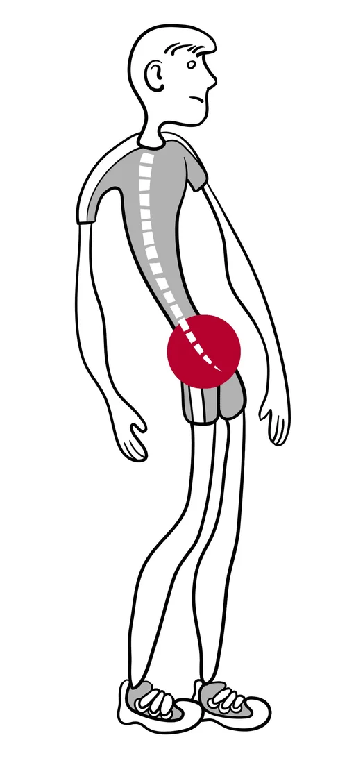 Pelvic Clock® Exercises for Swayback Posture Correction — Pelvic Clock ...