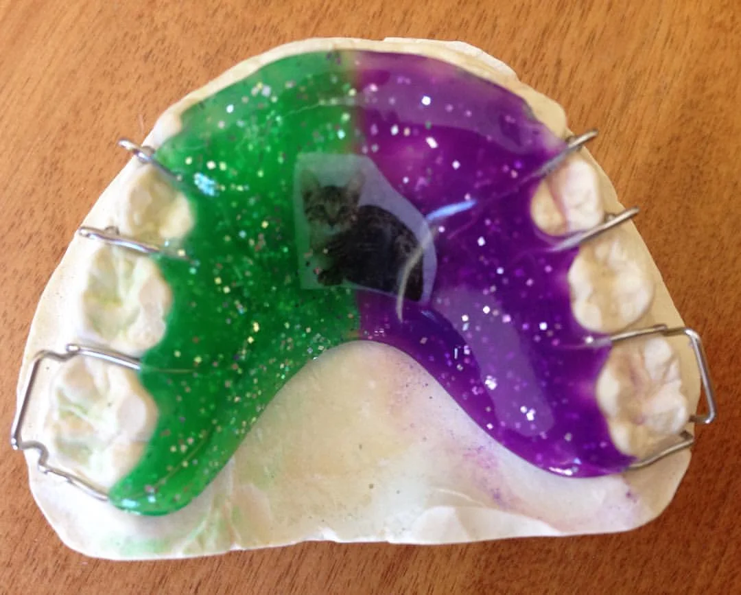 Wearing a Retainer - Kirk Orthodontics Carleton Place