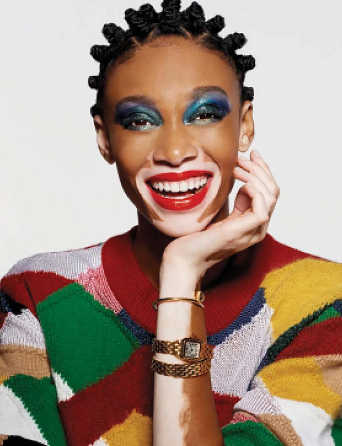 Winnie Harlow Reigns Supreme In Yu Tsai Images For Harper's Bazaar ...