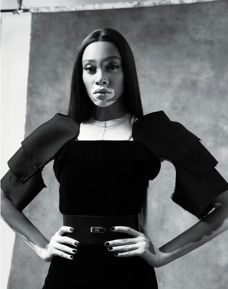 Winnie Harlow Adds Her Sensual Grace To Herring & Herring Magazine's 'Behold' Issue No. 5 — Anne ...
