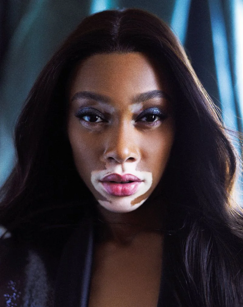 Winnie Harlow Adds Her Sensual Grace To Herring & Herring Magazine's 'Behold' Issue No. 5 — Anne ...