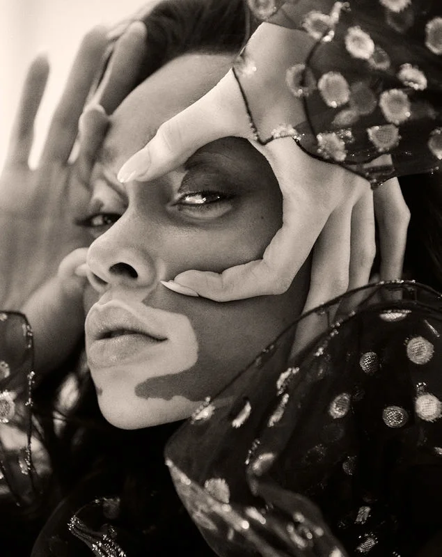 Winnie Harlow Tracks Style Spots + Cats In Elegance Lensed By Harper ...