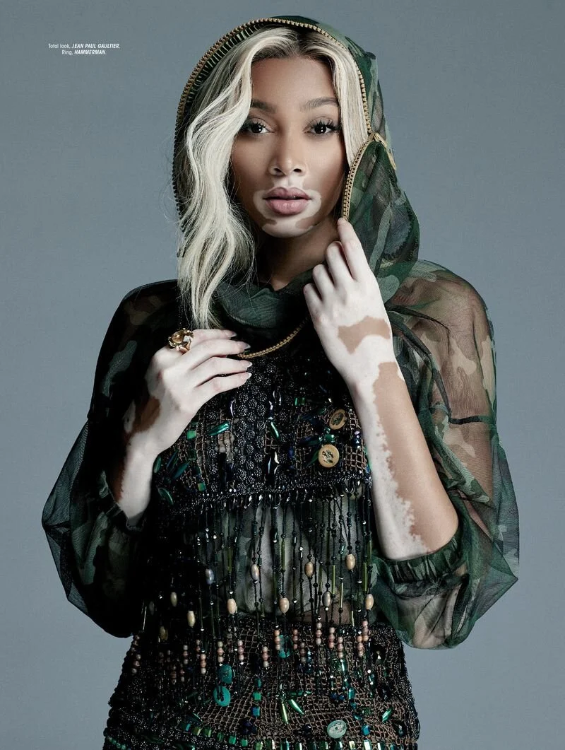 Winnie Harlow by Bryce Thompson for L'Officiel Cyprus Sp 2021 — Anne of ...