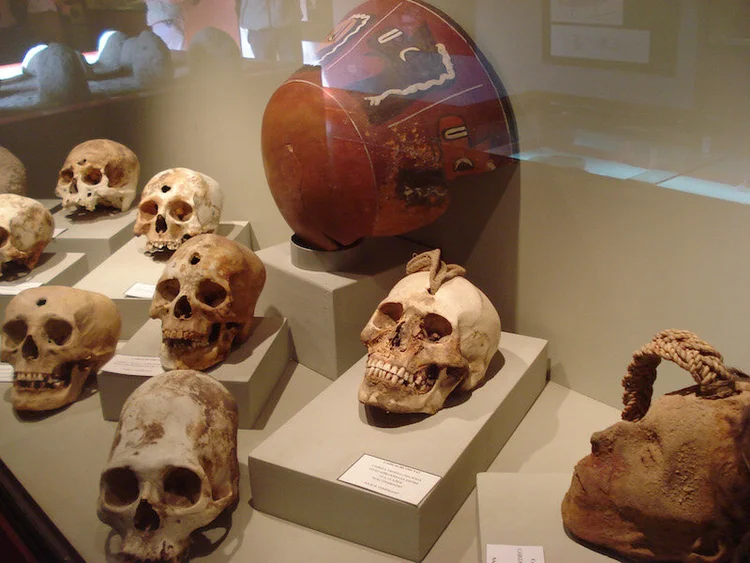 Paracas & Nazca Cultures | Trepanation & Head Deformation | Desert ...