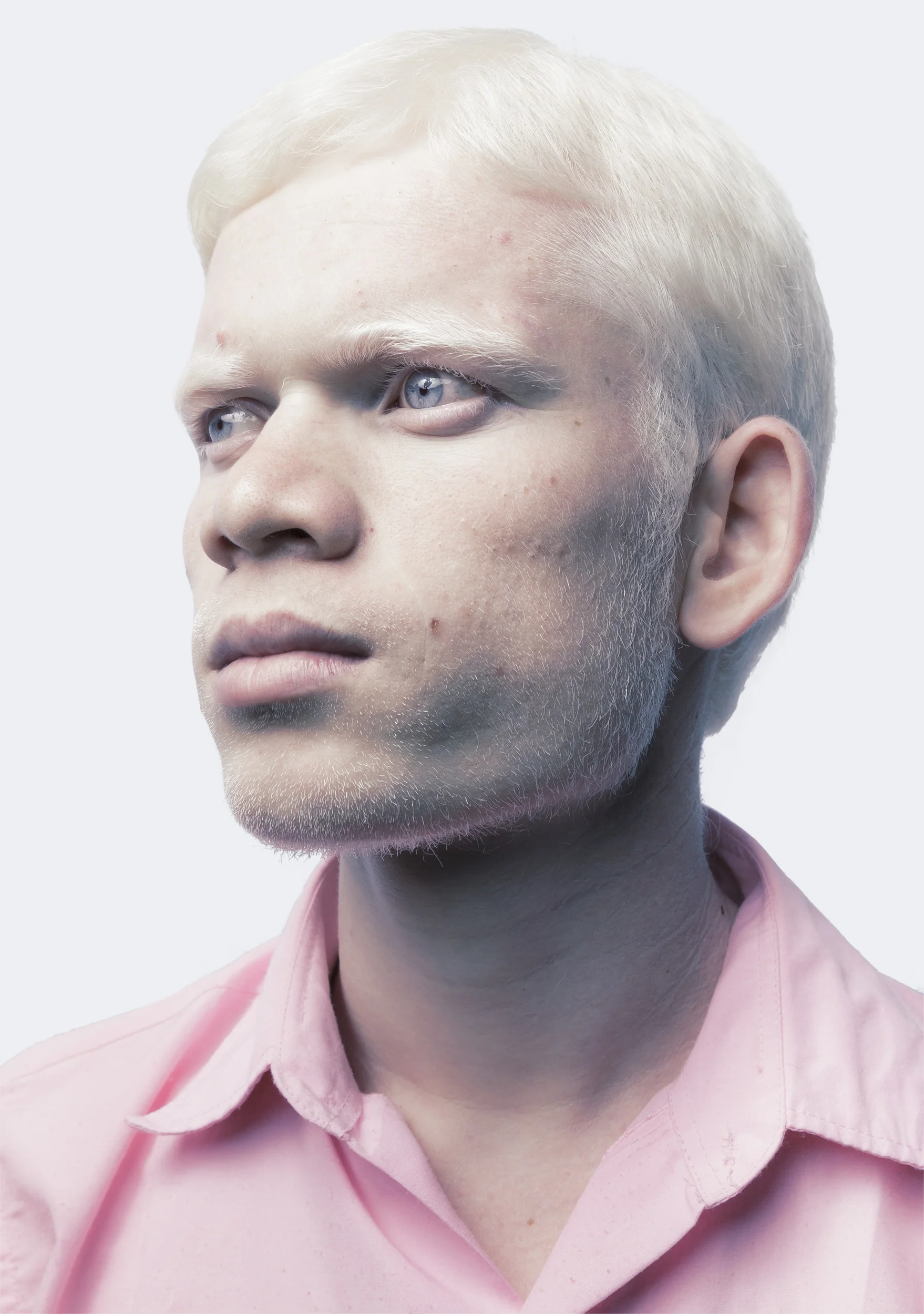 Indian Boys with Albinism — Brent Stirton