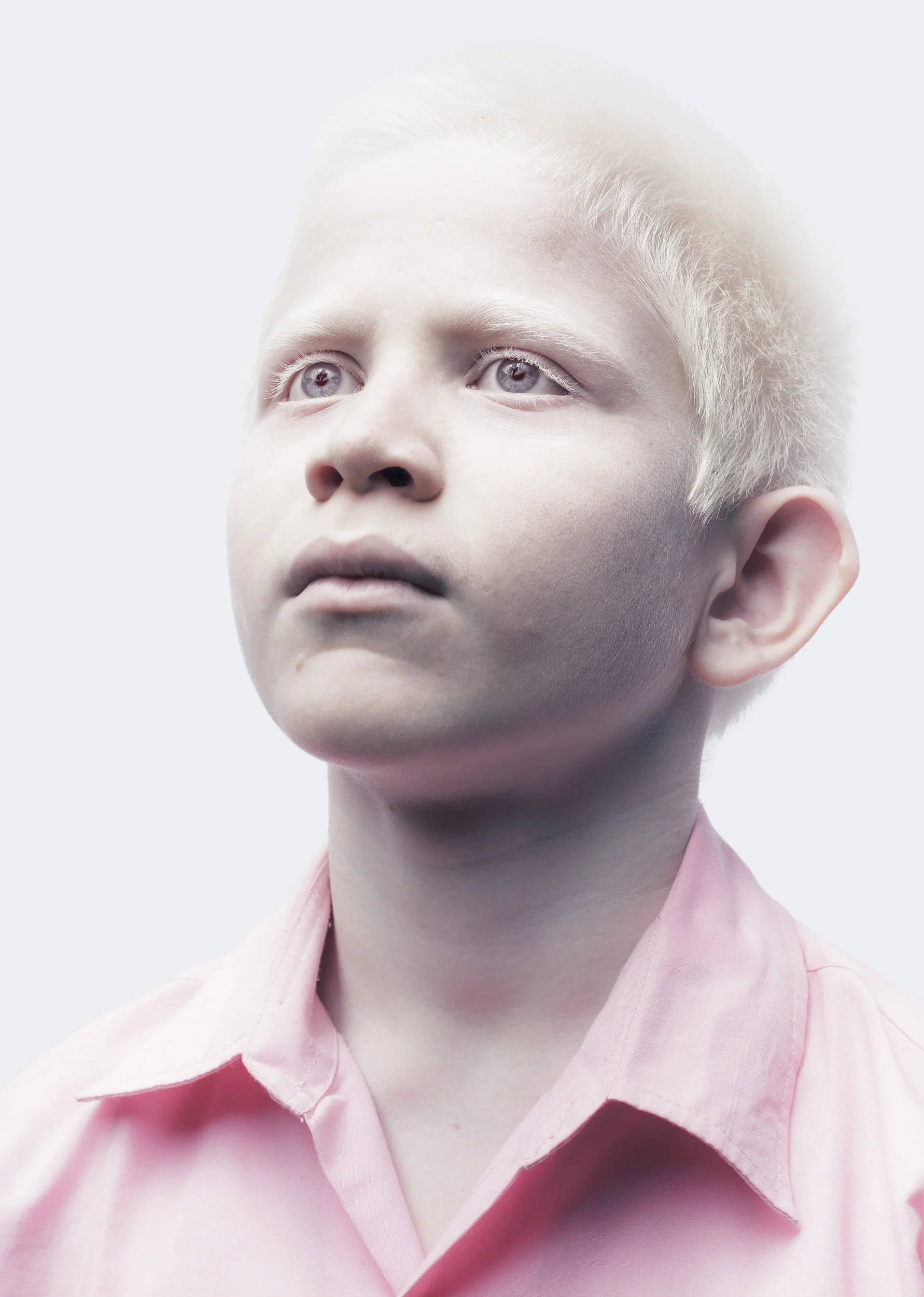 Indian Boys with Albinism — Brent Stirton
