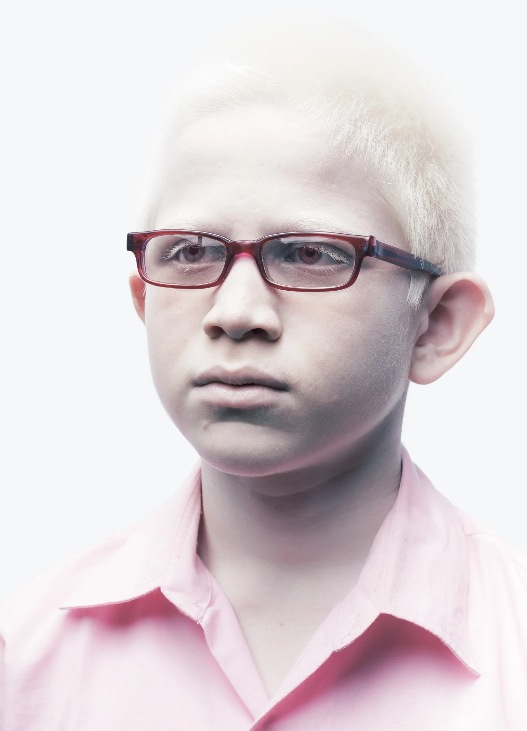 Indian Boys with Albinism — Brent Stirton