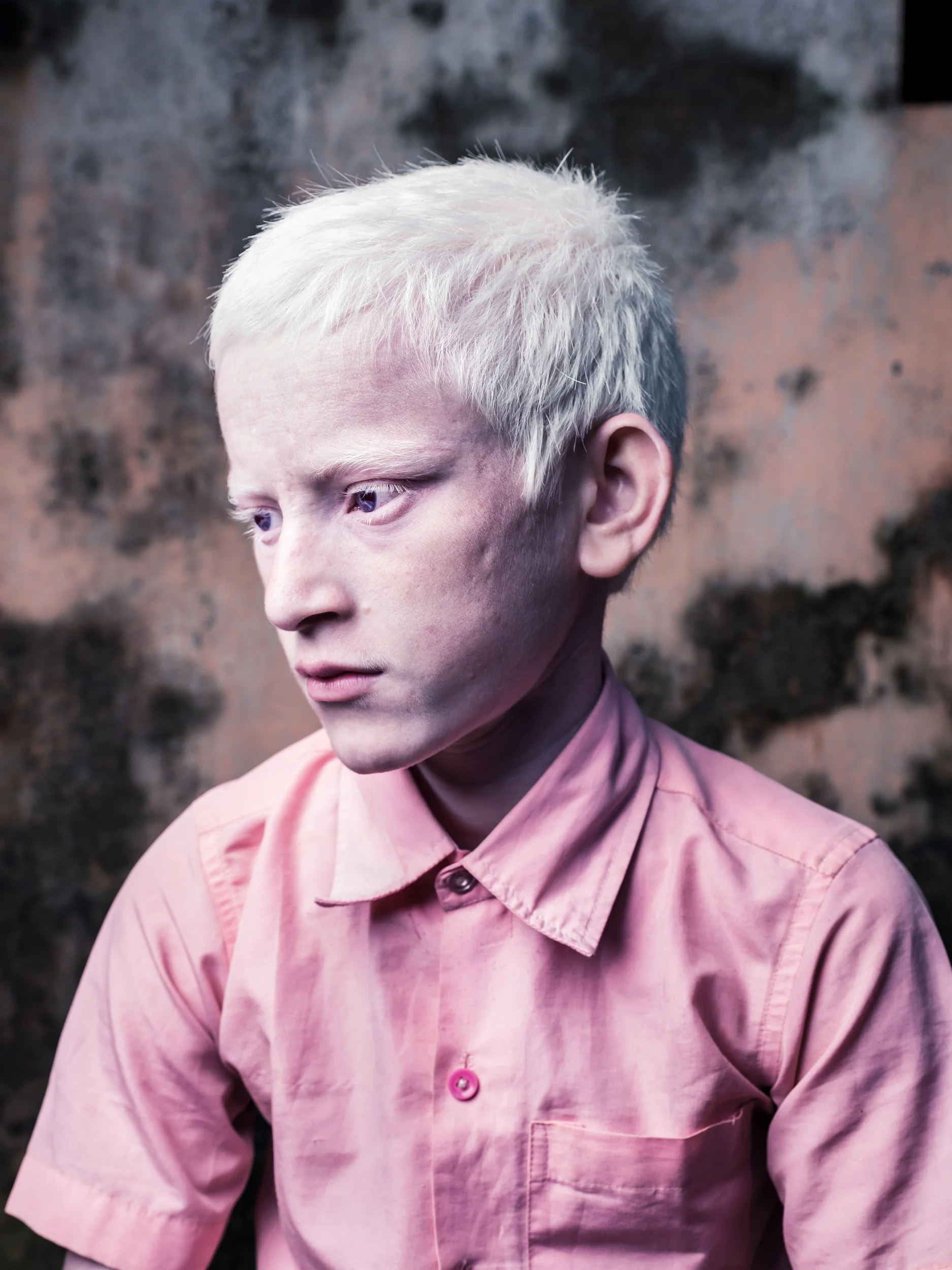 Indian Boys with Albinism — Brent Stirton