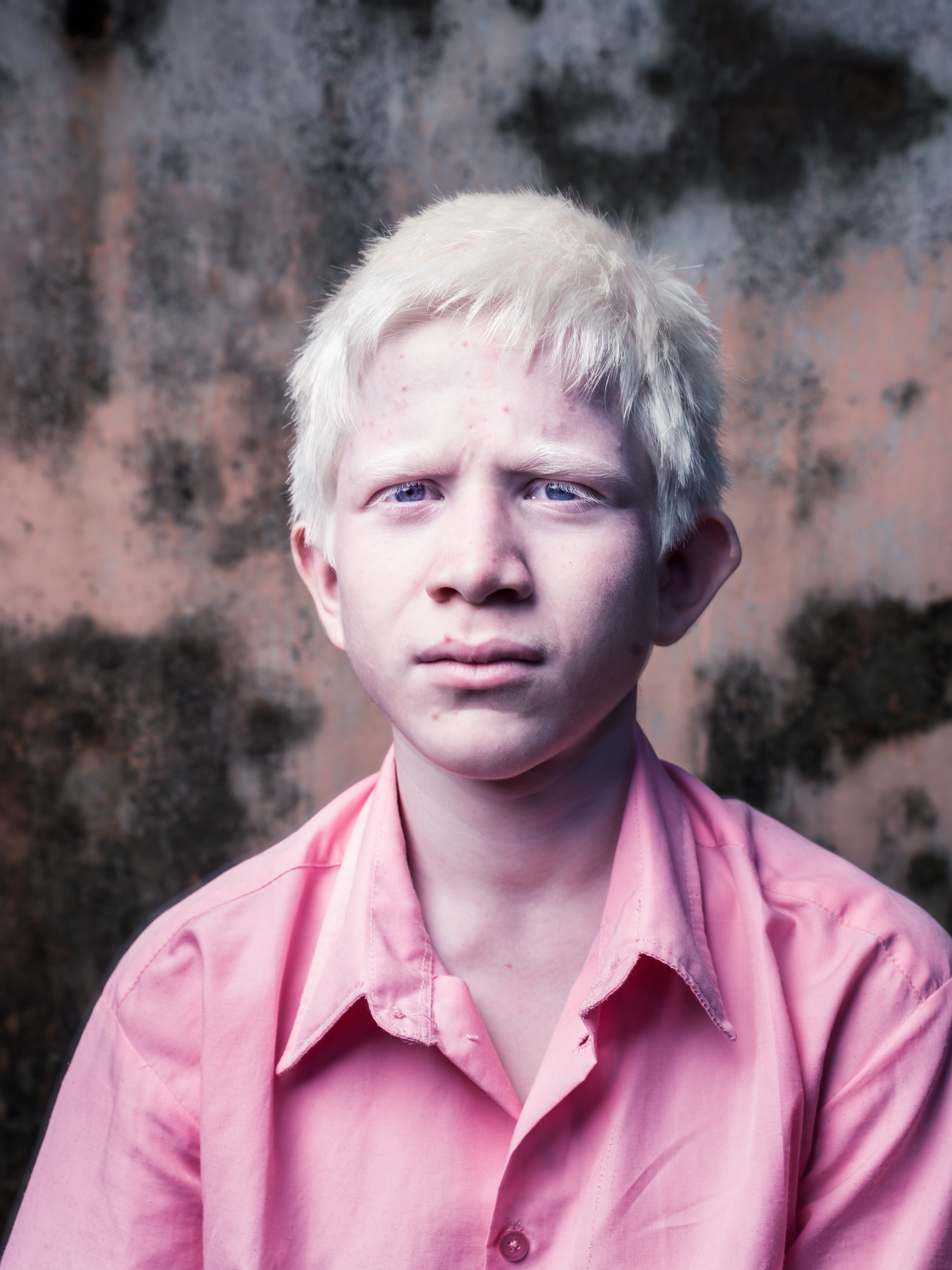 Indian Boys with Albinism — Brent Stirton