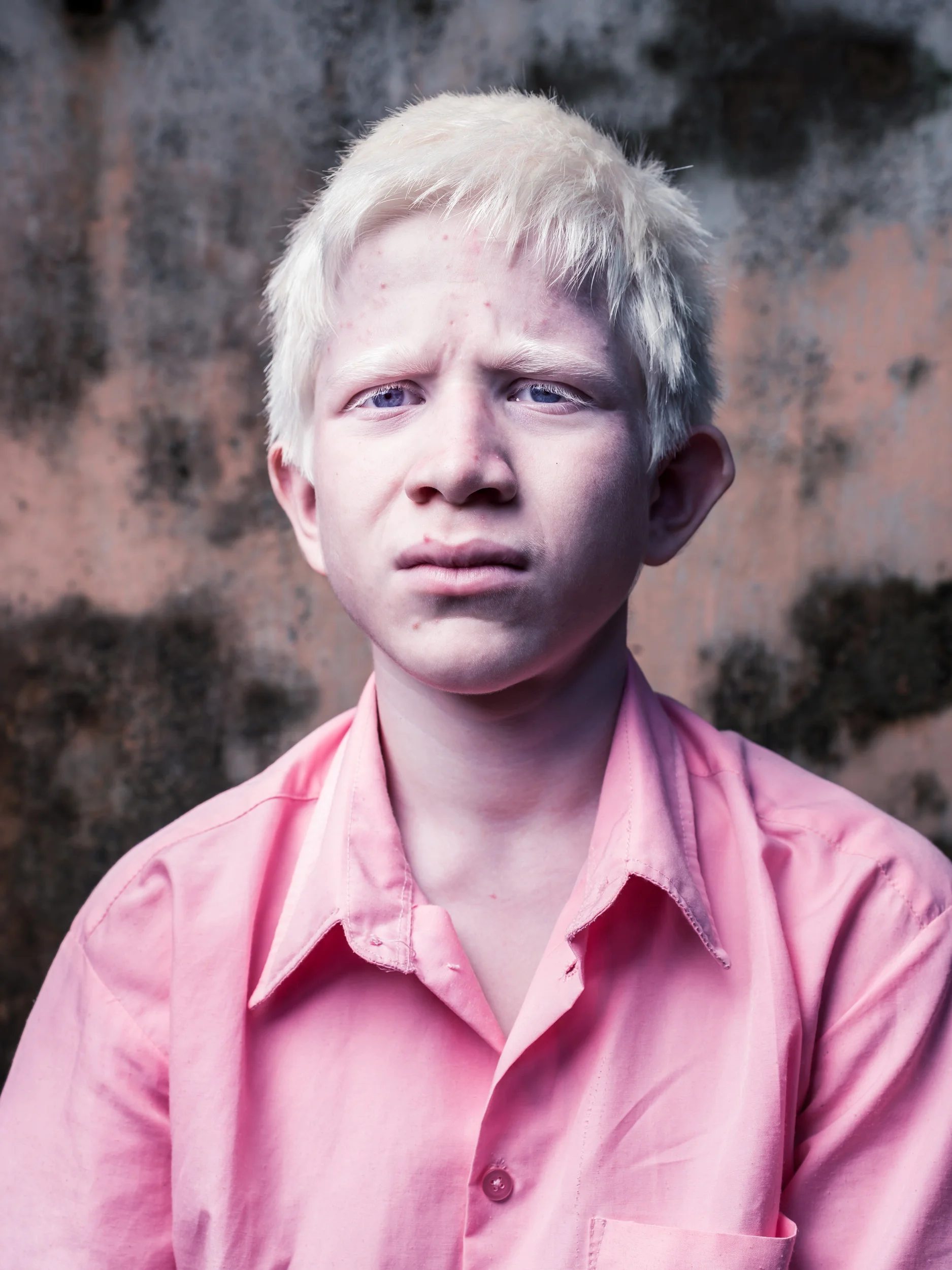 Indian Boys with Albinism — Brent Stirton