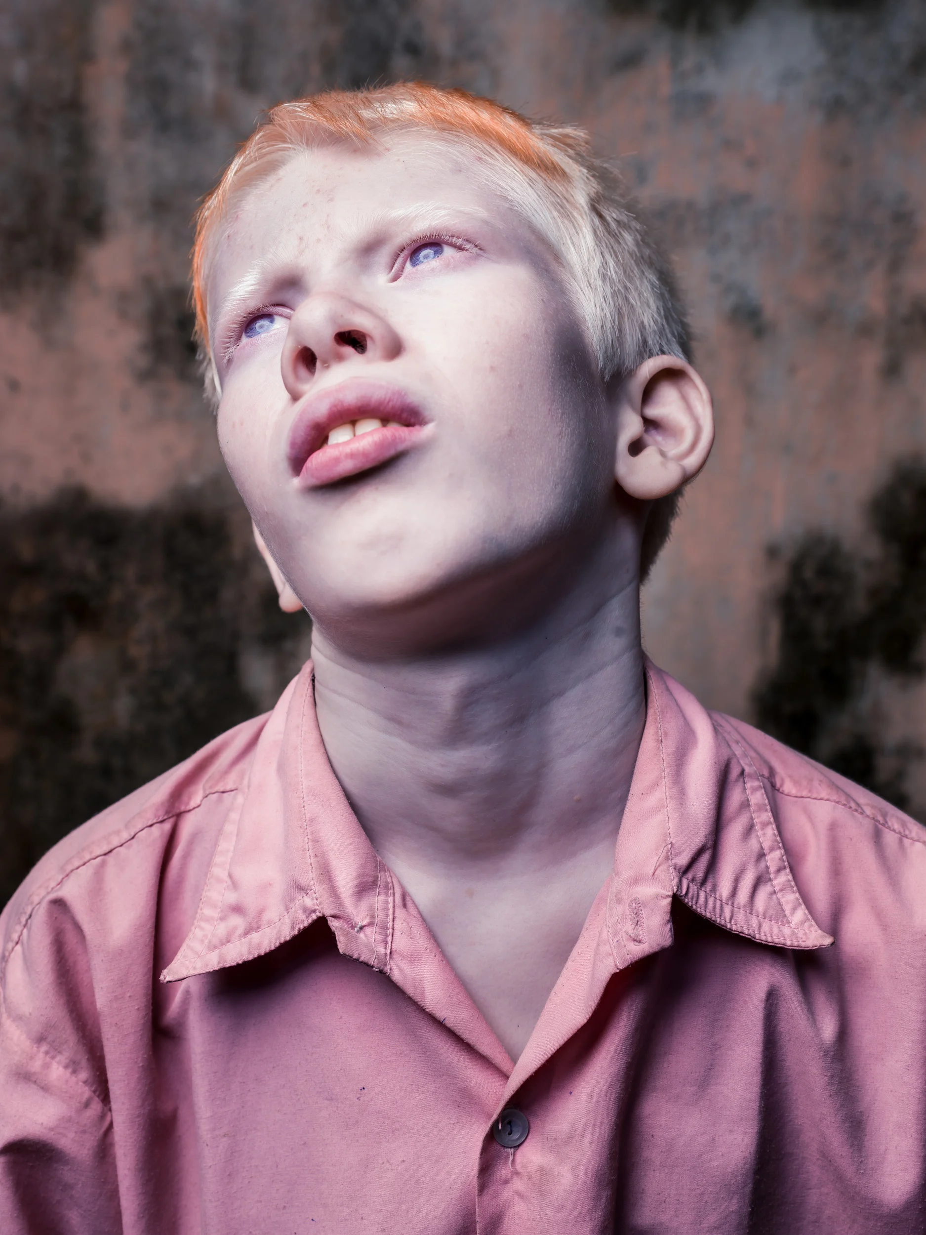 Indian Boys with Albinism — Brent Stirton