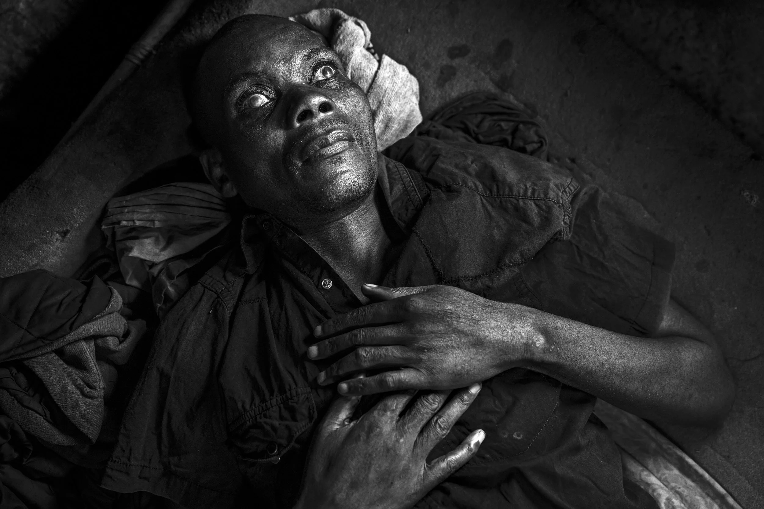 River Blindness - DR Congo — Brent Stirton