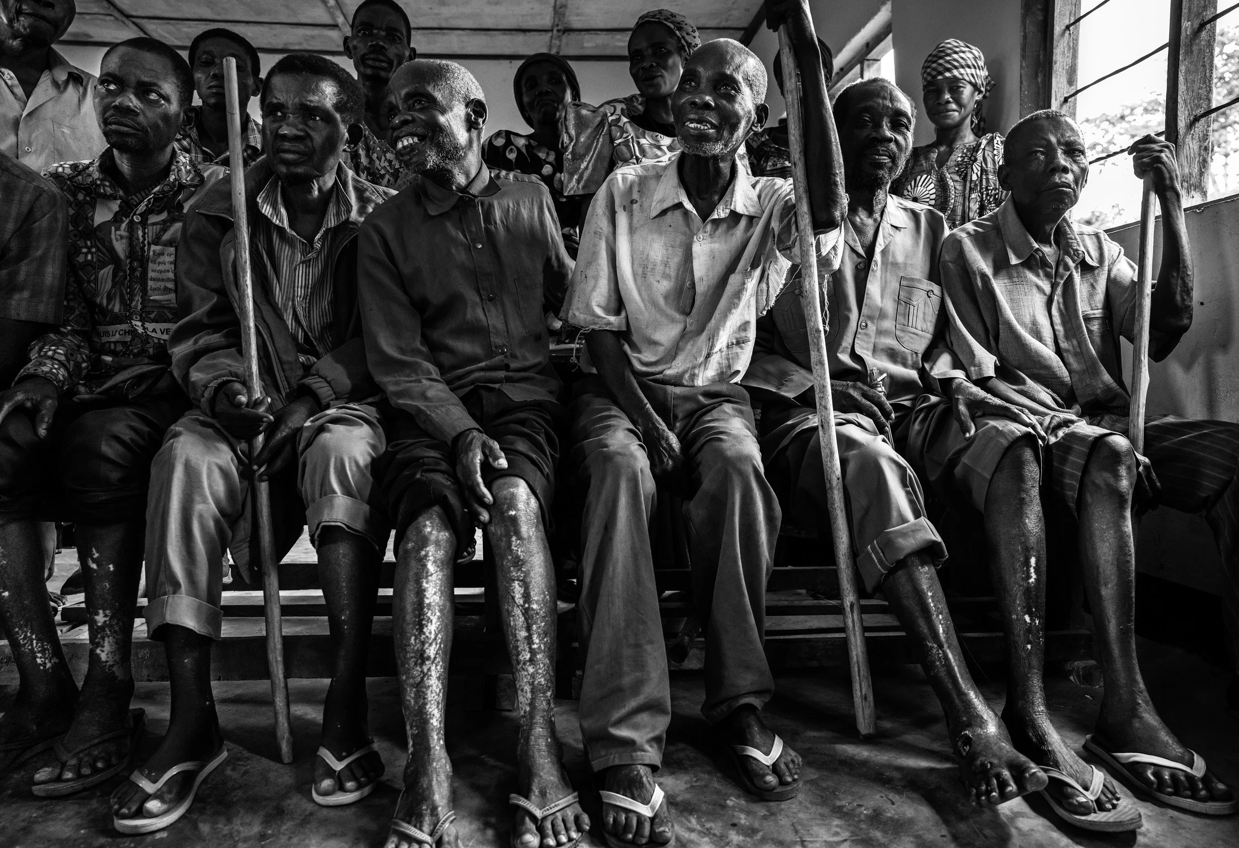 River Blindness - DR Congo — Brent Stirton