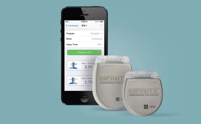 The Who, What, Where, When, and Why of Deep Brain Stimulation for ...