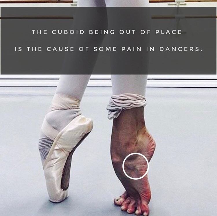 Cuboid — On the Move Physical Therapy