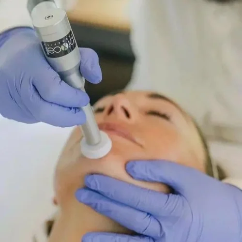 ProCell Microchanneling | DERMASPACE