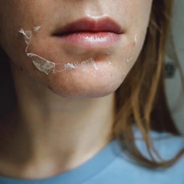 Seattle Facials & Electrotherapy Skincare | Dermaspace