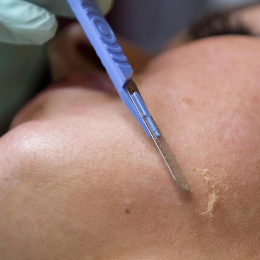 Seattle Facials & Electrotherapy Skincare | Dermaspace