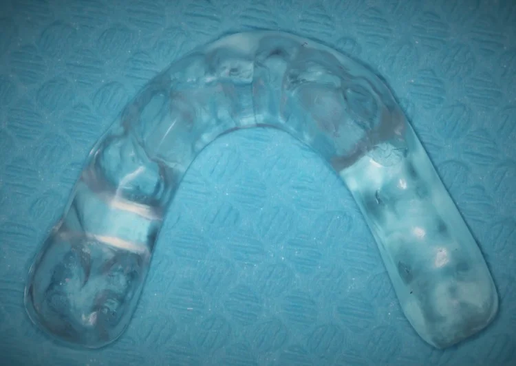 TMJ & Night Guards — Archway Dental