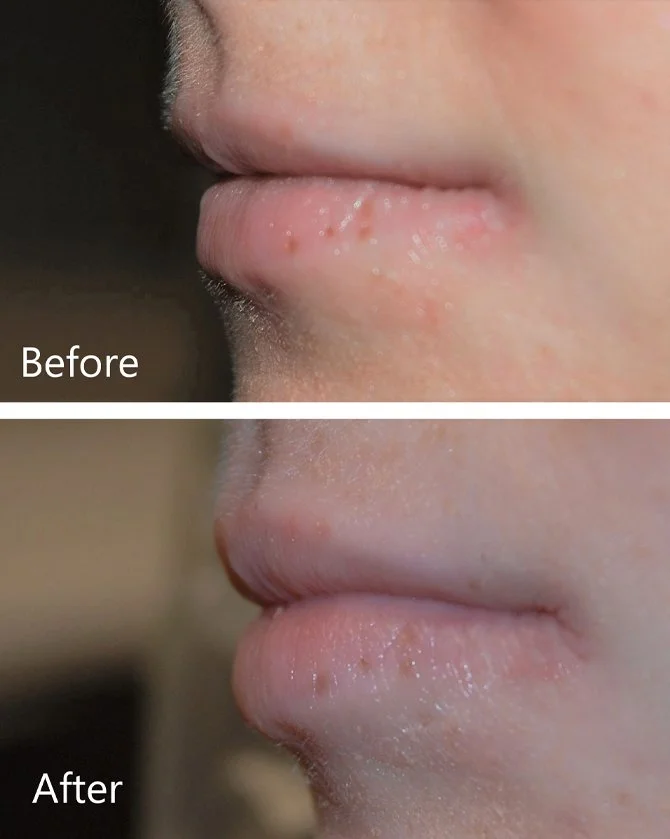 Edgewood Dental Services — Edgewood Dental