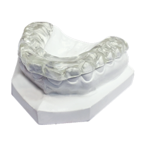Laboratory-made Occlusal Splints — S4S Dental