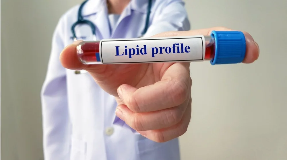 Laboratory Services — Highland County Health Department