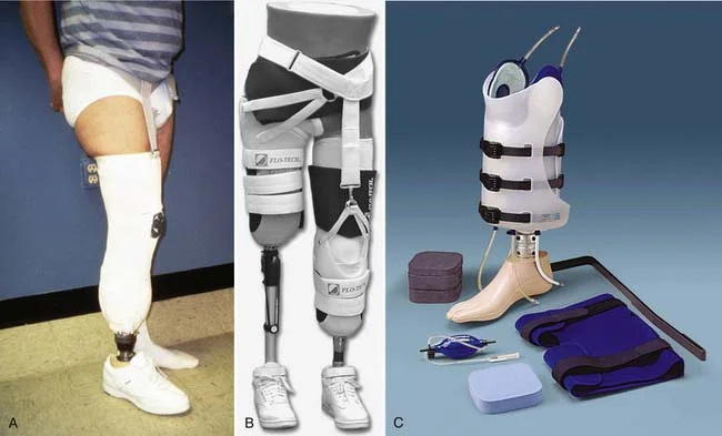 Prosthetics — Nouveau Prosthetics and Orthotics