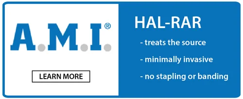 Hemorrhoid Treatment Options | Grades 3 + 4 - Hemorrhoid Treatment ...